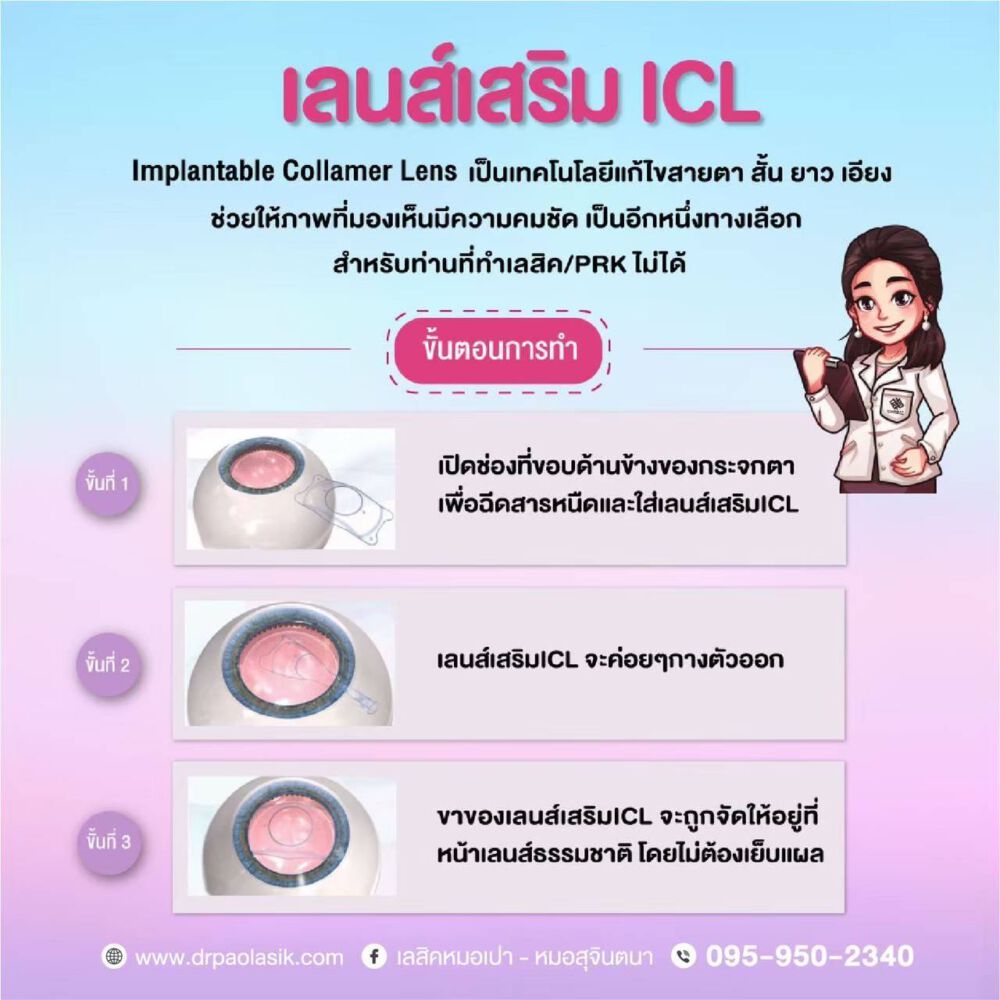 ขั้นตอนการผ่าตัดเลนส์เสริม (ICL) - เลสิคหมอเปา